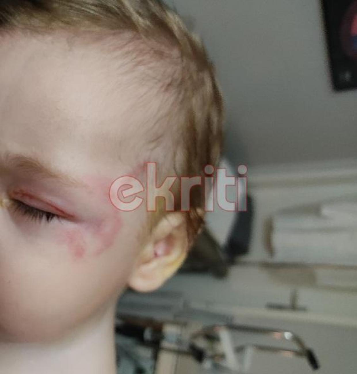Κρήτη: Ο σκύλος επιτέθηκε σε μωρό 8 μηνών και ο πατέρας ανταπέδωσε με ...